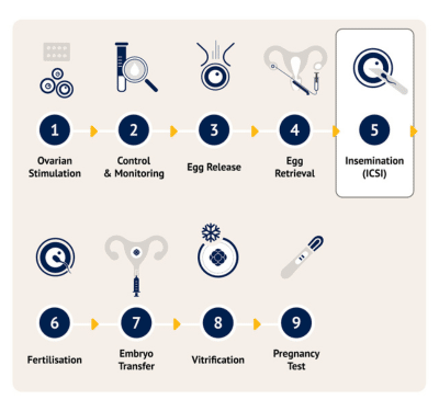 ICSI | IVF Fertility Treatment