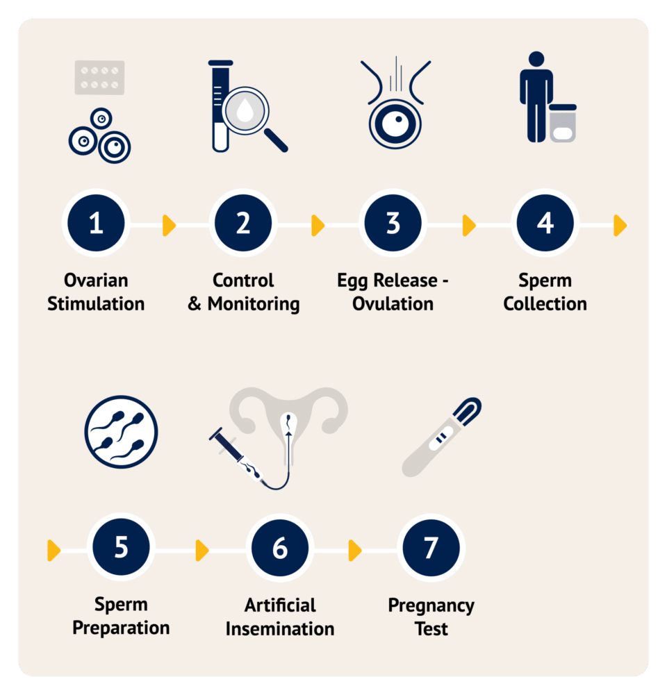 Artificial Insemination & IUI Treatment | City Fertility