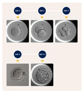 City FertilityThe Stages of Embryo Development| City Fertility