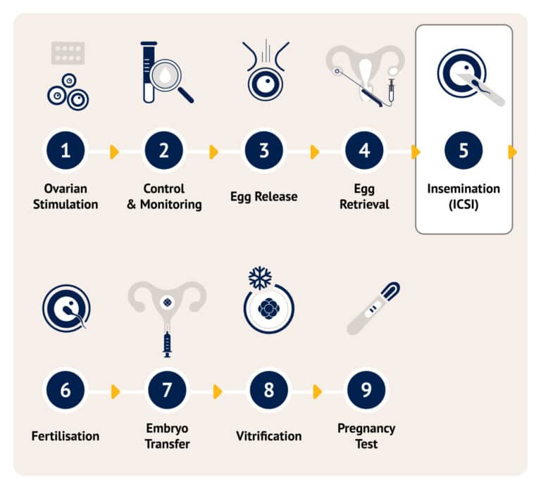 ICSI | IVF Fertility Treatment