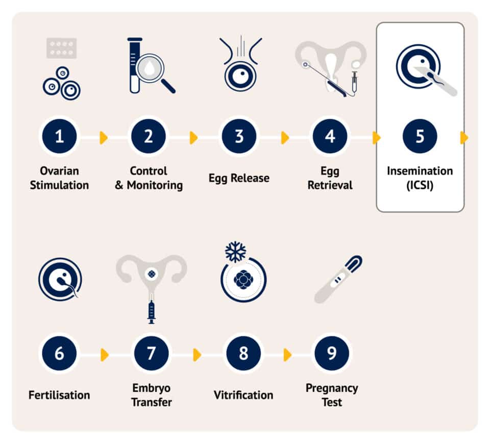 ICSI | IVF Fertility Treatment