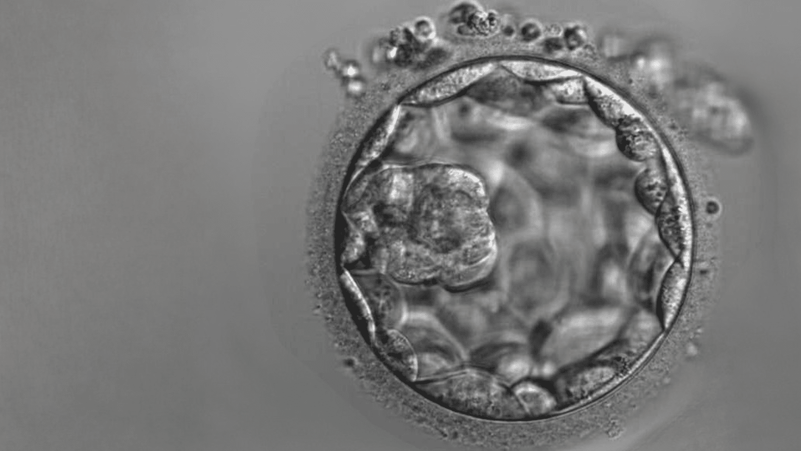 Understanding the Gardner Blastocyst Grading System in IVF | City Fertility